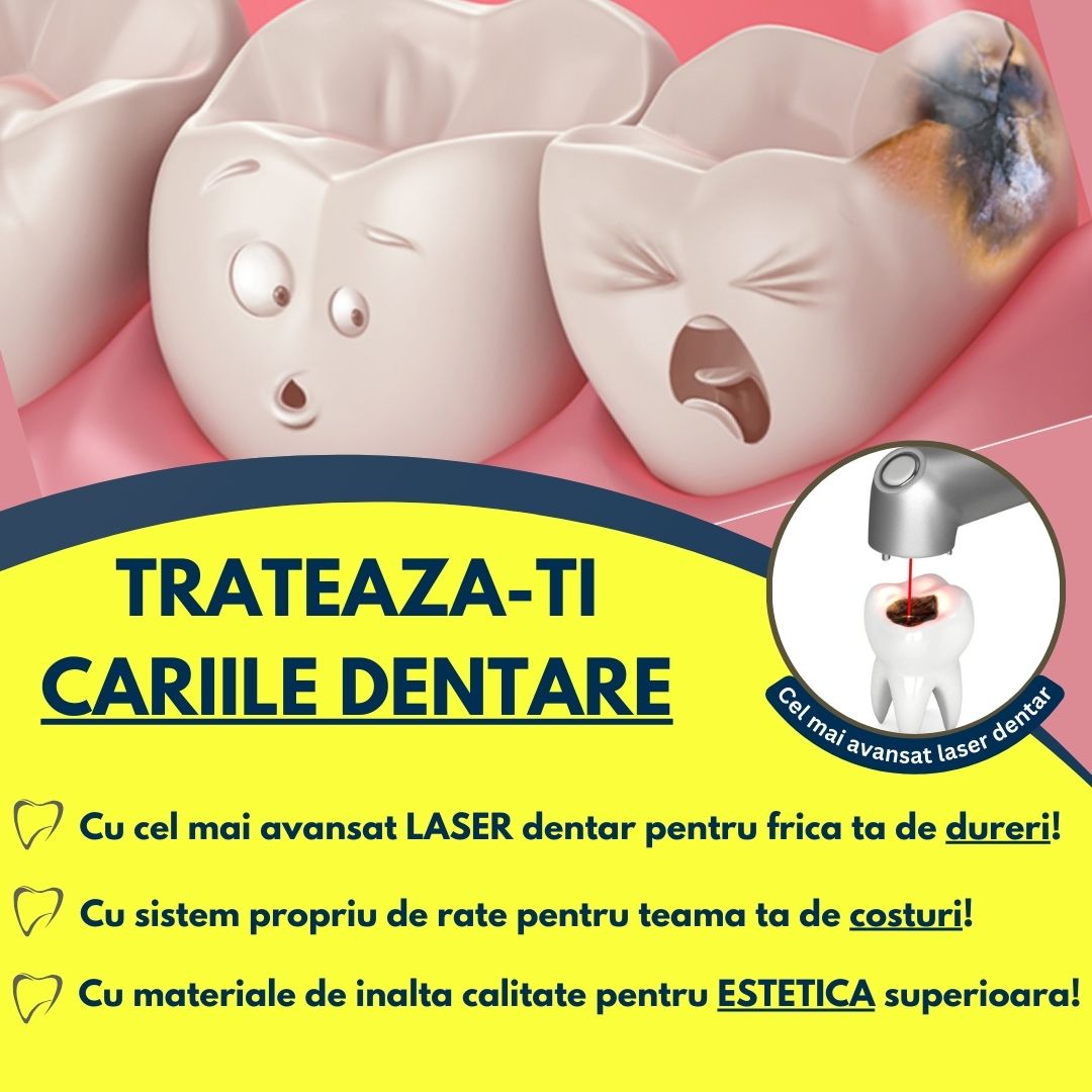 Lioness Dental ClinicTratamentul Cariilor dentare cu LASER